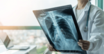 My Doctor Found a Spot On My Lung During a Chest X-Ray: Now What?